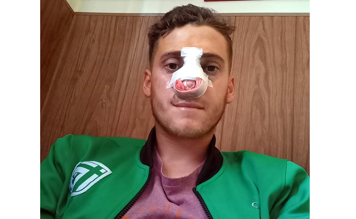 Pasaron por el quirófano - DiarioSports - San Francisco